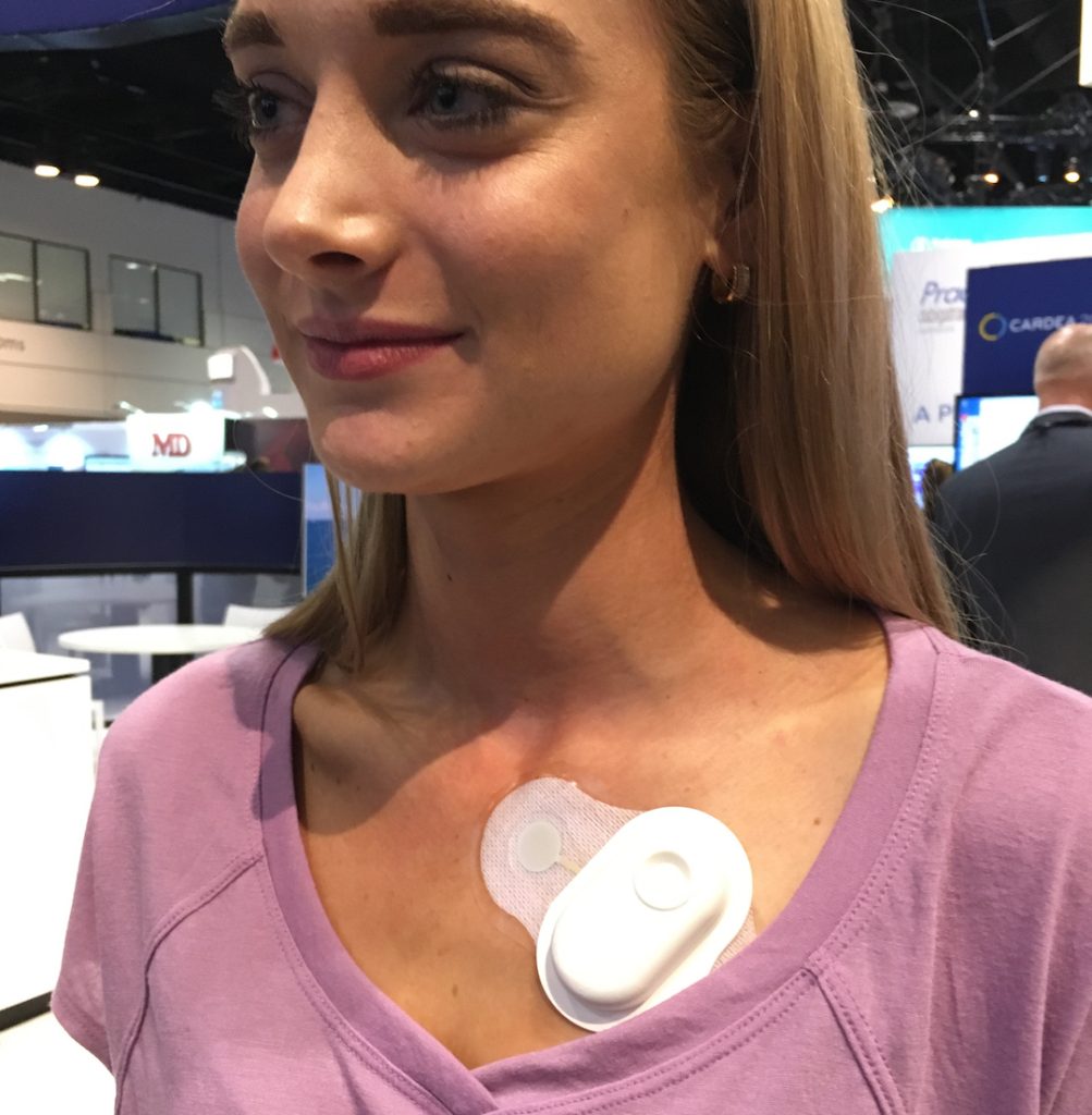 How Much is a Heart Monitor: Affordable Options and Prices